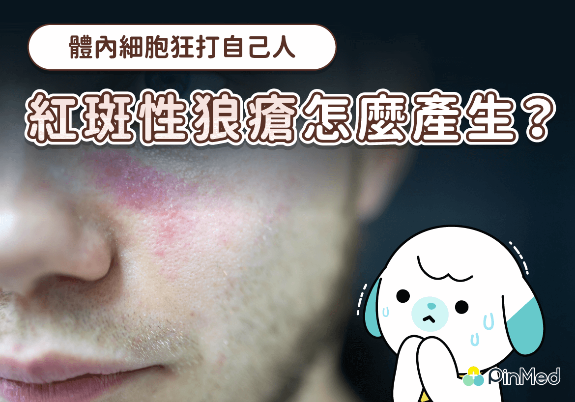 紅斑性狼瘡有哪些症狀？網傳會影響壽命是真的嗎？日常飲食這類食物要避免 - PinMed