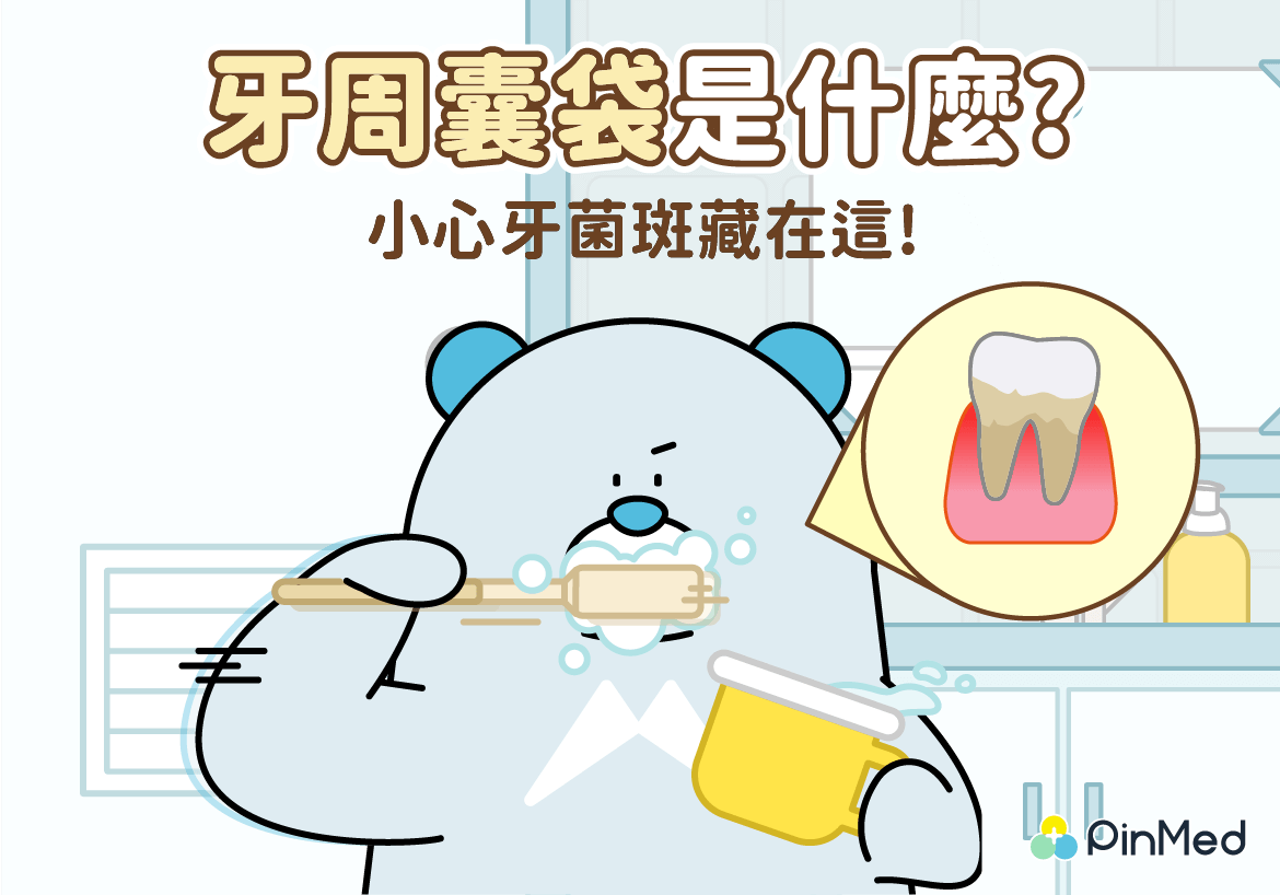 牙周囊袋是什麼？牙菌斑藏越深越嚴重！小心牙周病找上你 - PinMed
