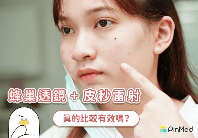 UP雷射全方位解析：離開凹疤月球表面！效果、費用、修復期一篇掌握 - PinMed