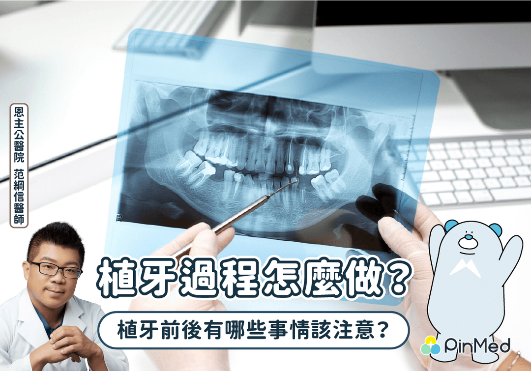 植牙怎麼做？一定會成功嗎？植牙過程、注意事項、後遺症完整解析 - PinMed